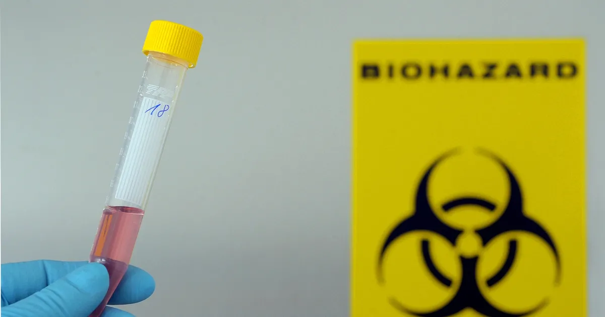 Virus auf Station 41: Klinikum-Direktorin gibt Entwarnung - Nahe ...